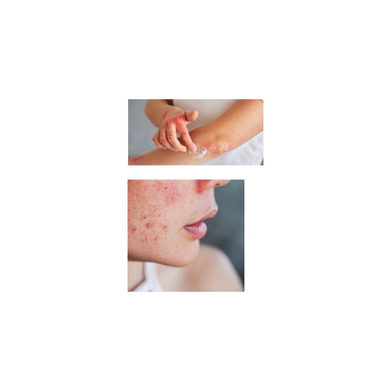 PSORIX: Keratolytický šampon (Lupenka) 250ml